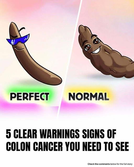 5 Concerning Red Flags That May Signal Colon Cancer - News Article